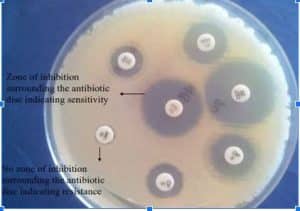 Kirby Bauer- Disc diffusion method - Chemistry Notes