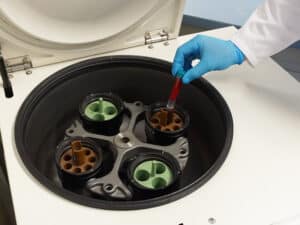Centrifugation: Definition, Principle, Types, and 3 Reliable ...