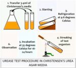 Urease Test: Principle, Protocol, Results, And Reliable Uses ...