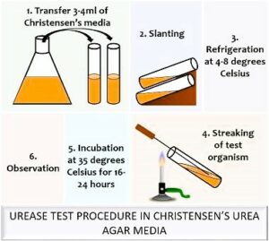 Urease Test: Principle, Protocol, Results, And Reliable Uses ...