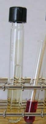 Nitrate Reduction Test: Principle, Protocol, And Reliable Application ...