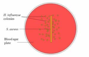 Satellitism Test: Principle, Reagents, Protocol, And Reliable ...